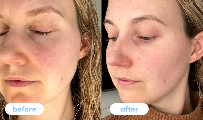 Results – The Collagen Co NZ